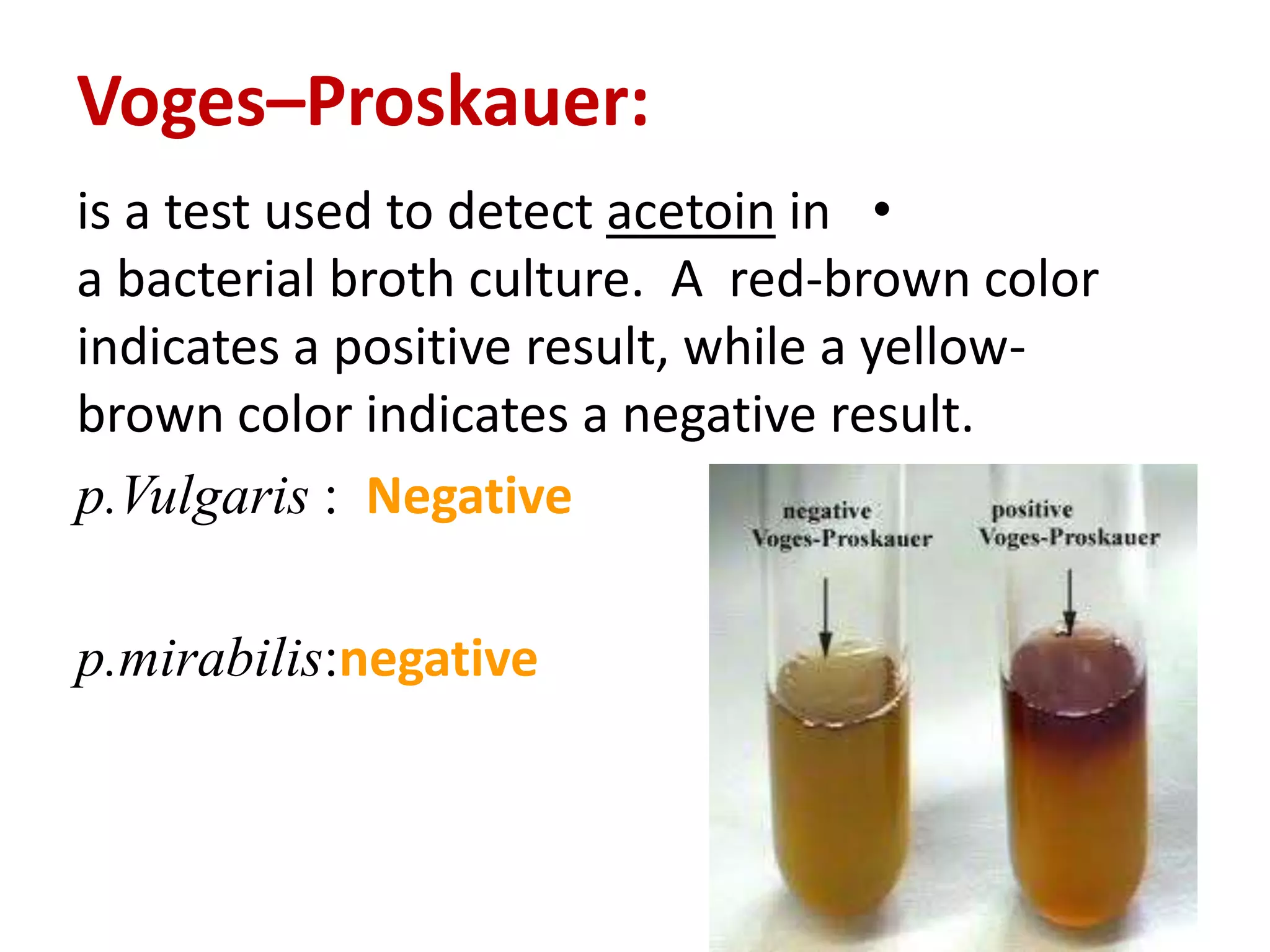 Proteus spp (2) | PPTX