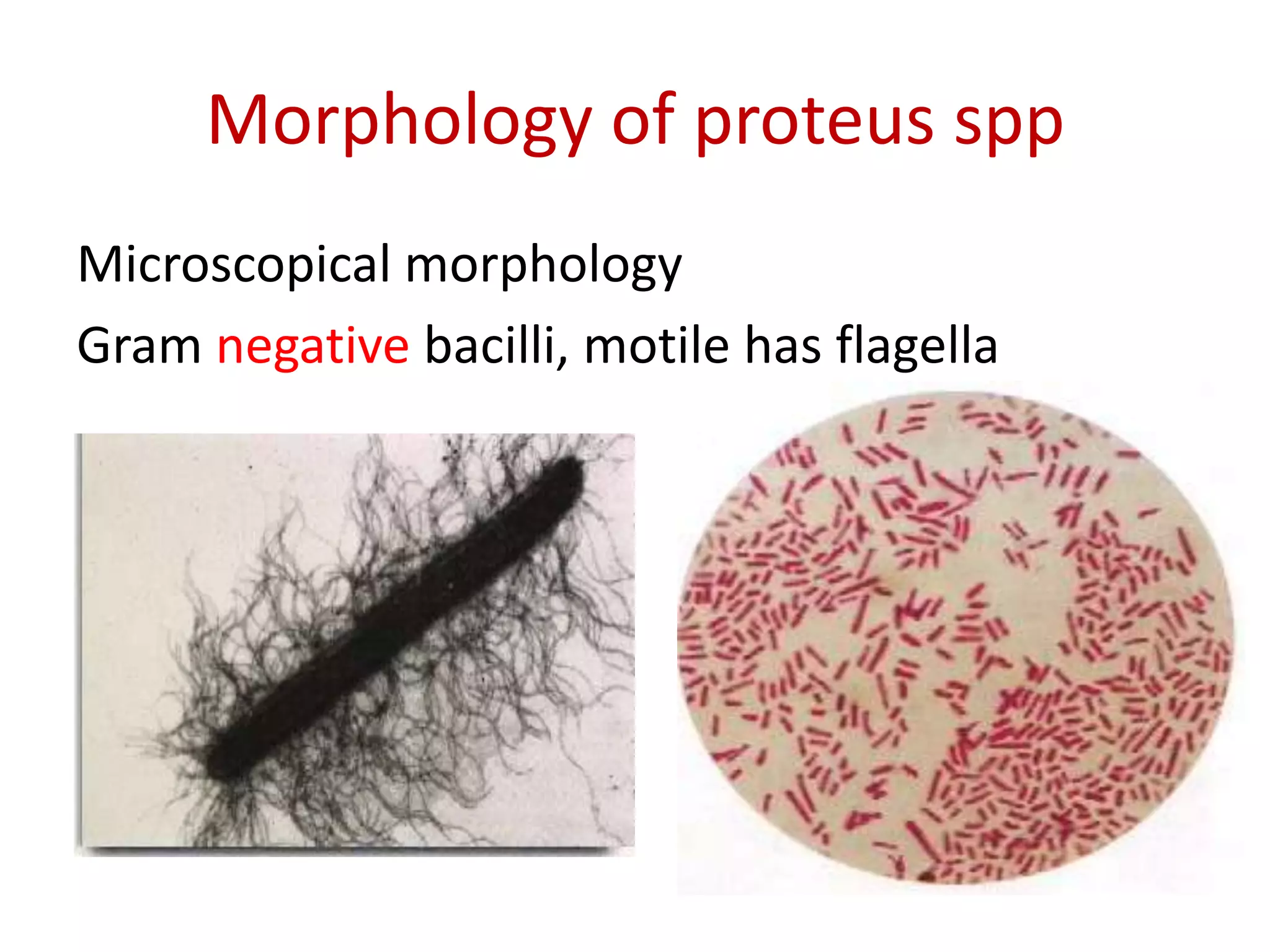 Proteus spp (2) | PPTX