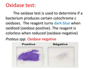 Proteus spp (2) | PPTX