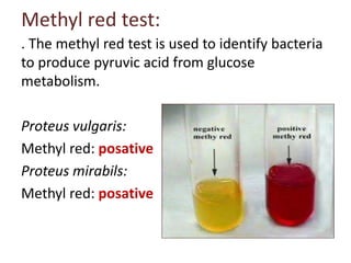 Proteus spp (2) | PPTX