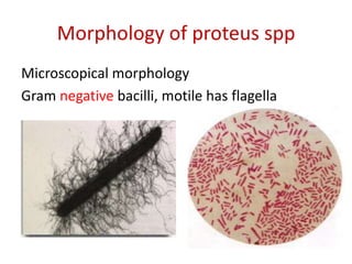 Proteus spp (2) | PPTX