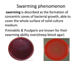 Proteus Mirabilis On Blood Agar