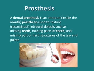 Different types of dental prosthesis | PDF