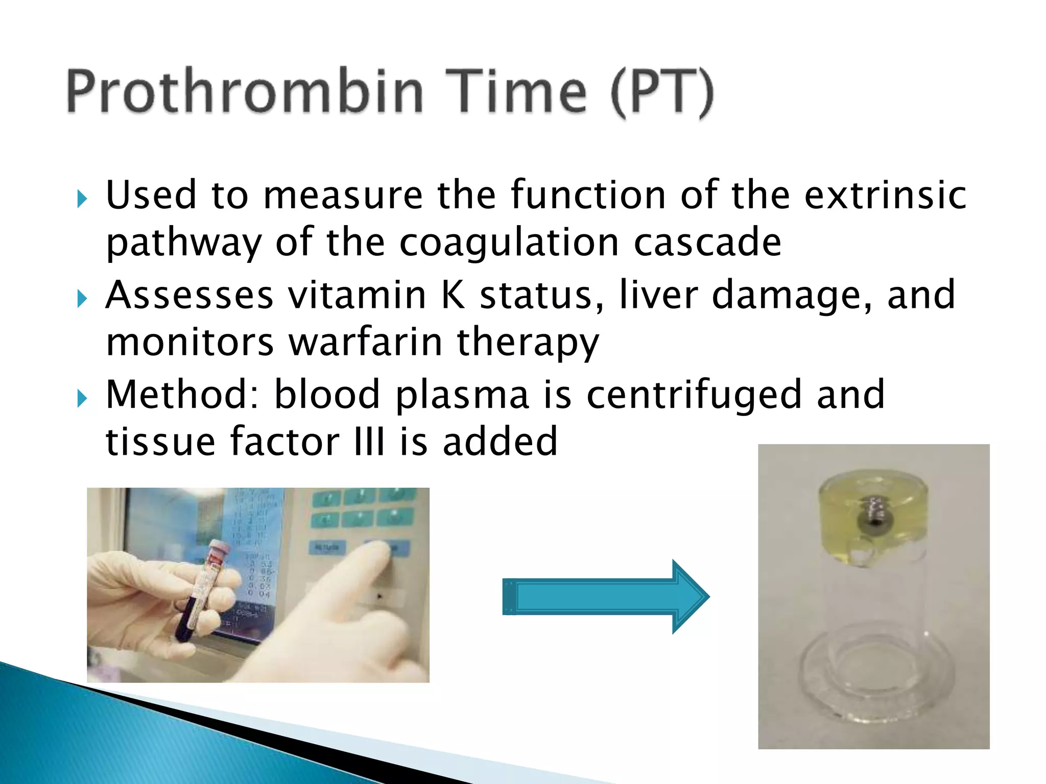 Prothrombin and Partial Thromboplastin Time | PPT