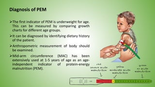 Protien Energy Malnutrition and Obesity.pdf