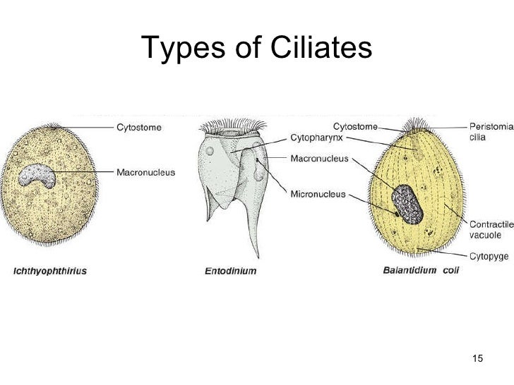 Types Of Protists List