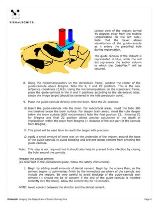 Protocol: Imaging the Deep Brain of Freely Moving Mice | PDF