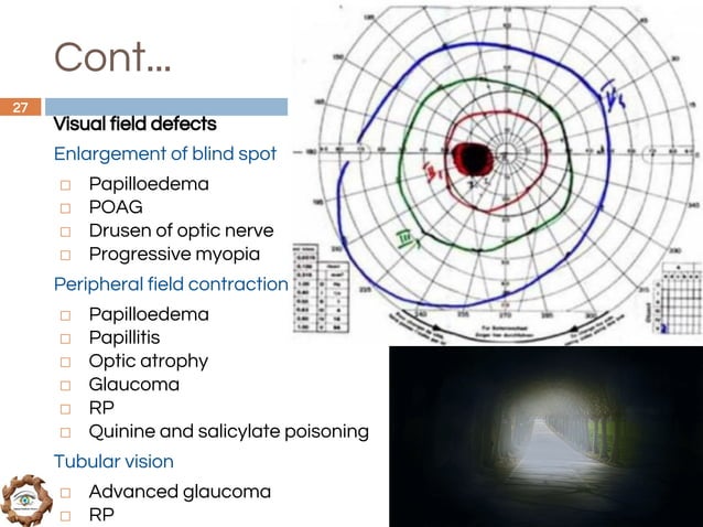 Protocol for differential diagnosis of common ocular diseases | PDF