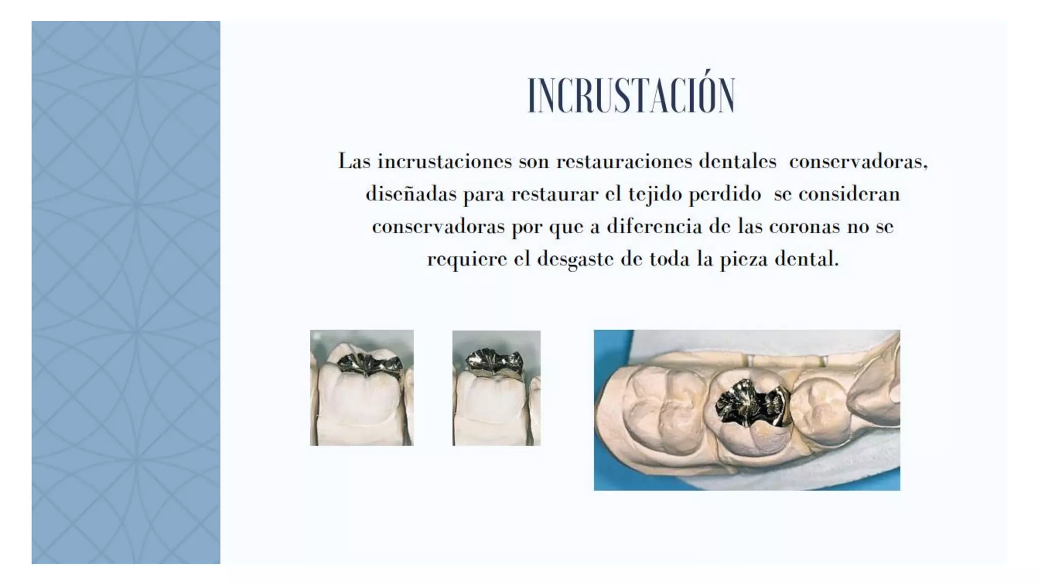 Incrustacion Metalica | PPT