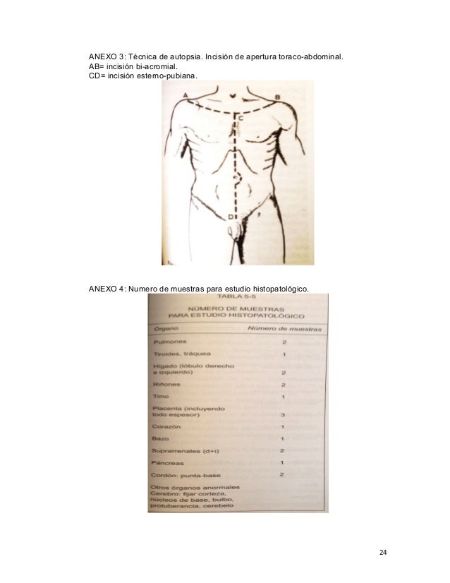 Protocolo de autopsia medico legal