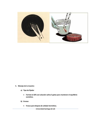 Protocolo de biopsia hemangioma catherin garces | PDF