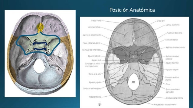 Protocolo de silla turca en tc