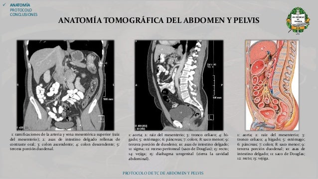 PROTOCOLO DE TOMOGRAFÍA COMPUTADA DE ABDOMEN Y PELVIS