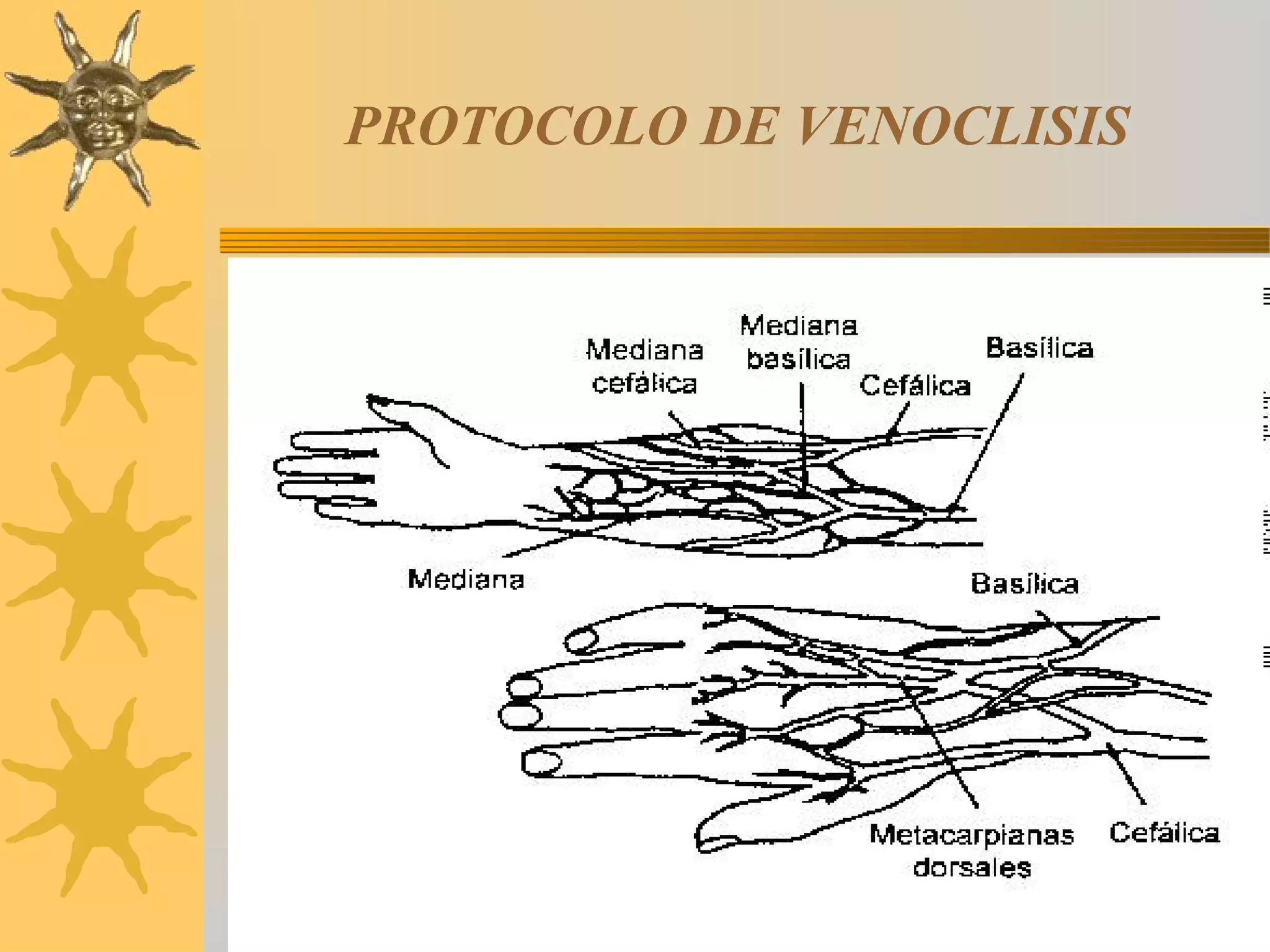 Protocolo de venoclisis
