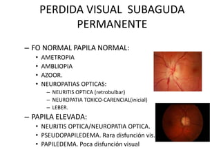 Protocolo en neuropatias opticas | PPTX