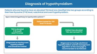 protocol of management of hypothyroidism .pptx