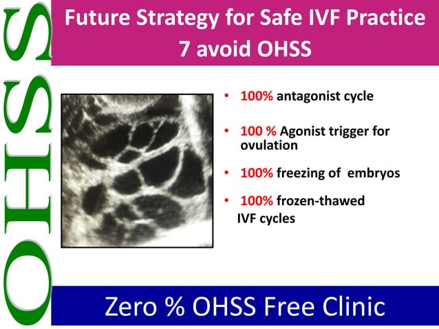 SIMPLE PROTOCOL of MANAGEMENT OVARIAN HYPERSTIMULATION SYNDROME (OHSS ...