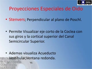 Protocolo TC oidos | PPTX