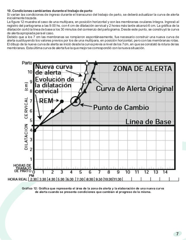 Protocolo partograma clap