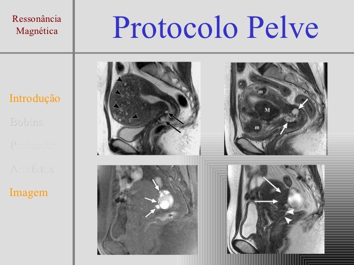 Protocolo Exame de Ressonancia Magnética da Pelve