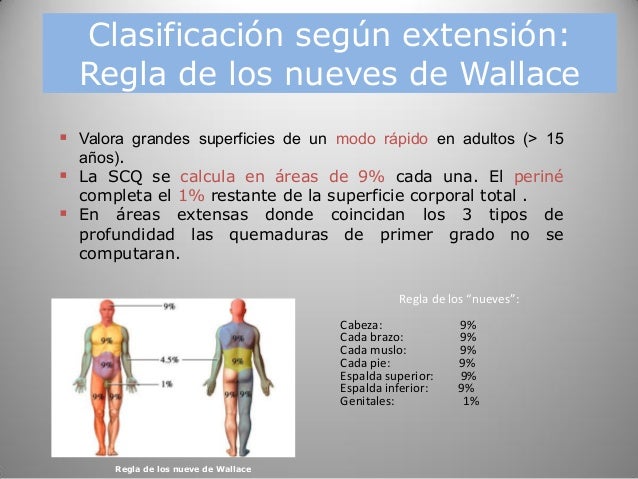 Escala De Los 9 Quemaduras – Regla De 9 Quemada – OAPHT