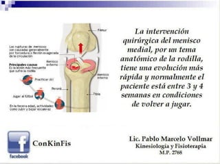 protocolo rehabilitacion menisco interno post cirugia | PDF