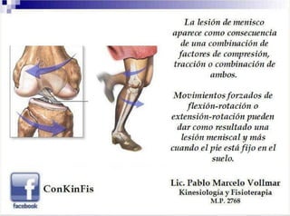 protocolo rehabilitacion menisco interno post cirugia | PDF