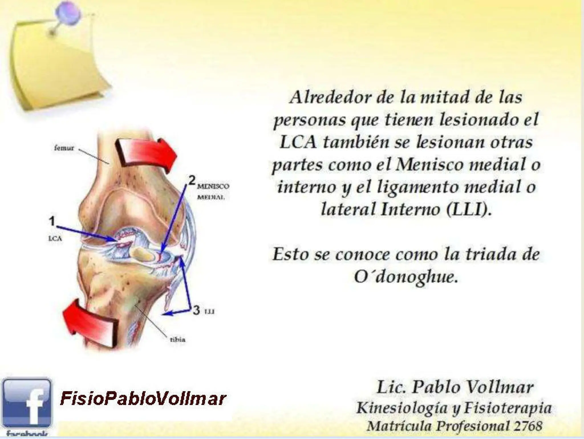 protocolo rehabilitacion rotura ligamento cruzado anterior lca.PDF