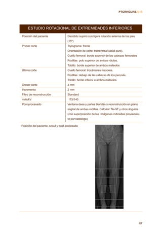 PROTOCOLOS_DE_TOMOGRAFIA_COMPUTERIZADA_S.pdf