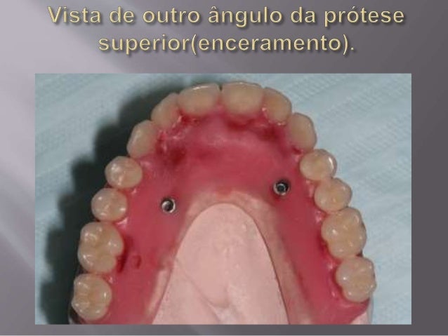 Protocolo superior e inferior