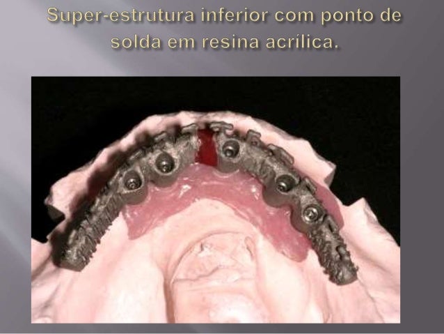Protocolo superior e inferior