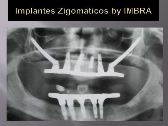 Protocolo superior e inferior