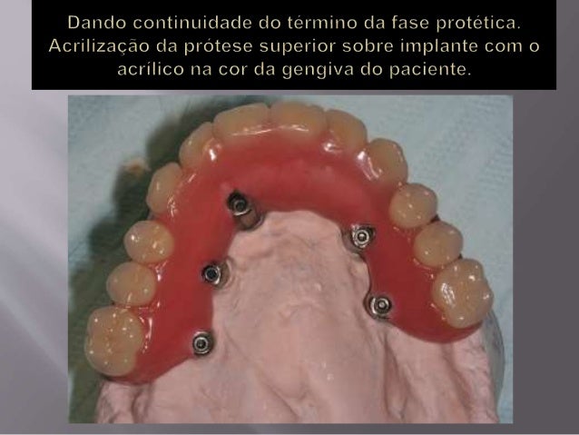 Protocolo superior e inferior