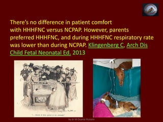 Heated humified high flow nasal cannula, does it have a rule in NICU ...