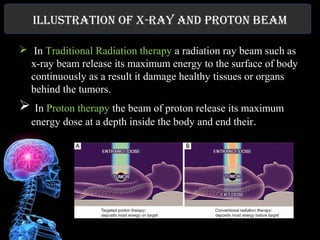 Proton beam therapy for tumors of skull base | PPT