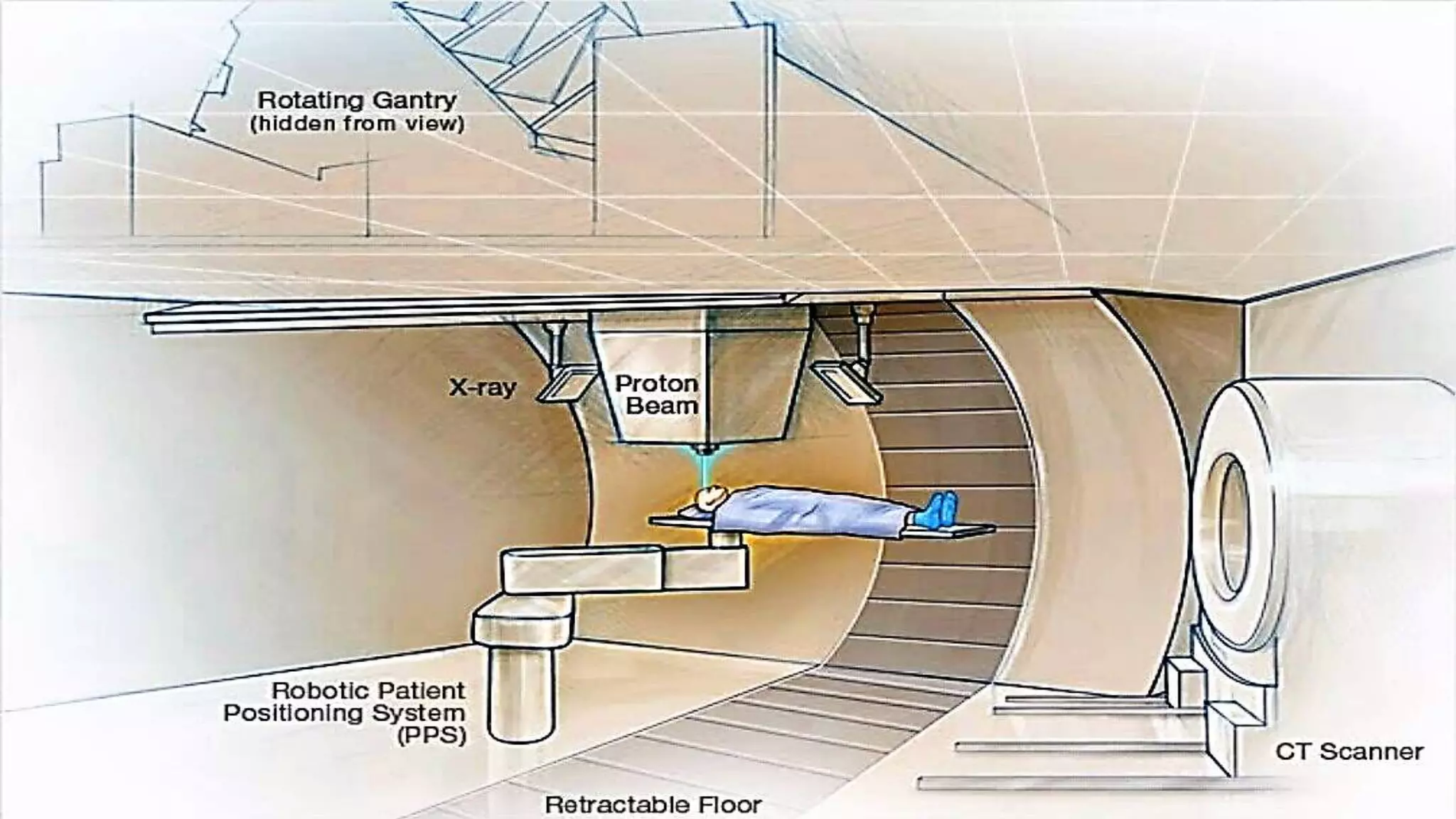 Proton beam therapy | PPTX
