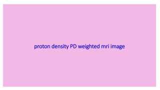 proton density PD weighted mri image.pptx