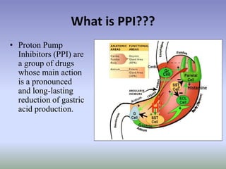 Proton Pump Inhibitor (PPI) | PPT