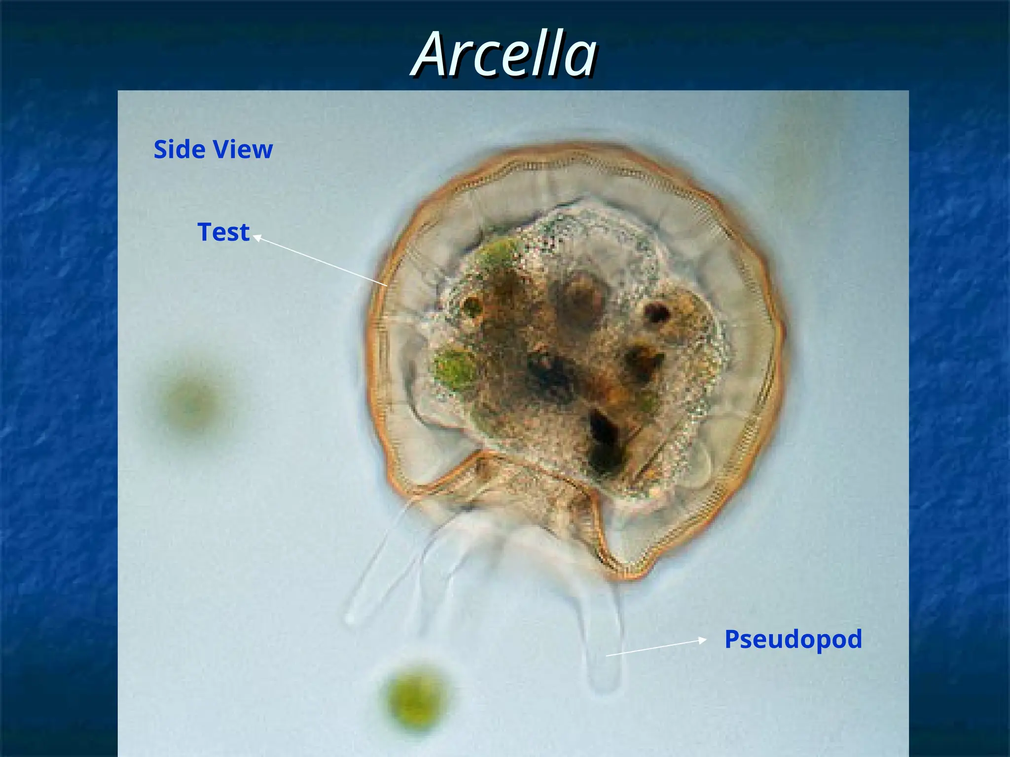 medical Protozoa , human protozoa unicellular parasites.ppt