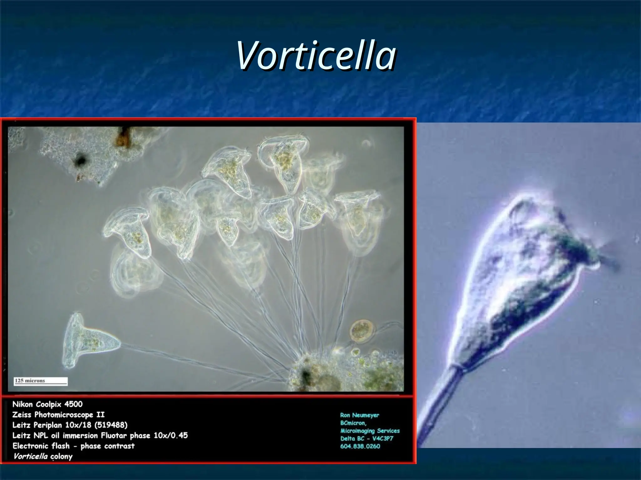 medical Protozoa , human protozoa unicellular parasites.ppt