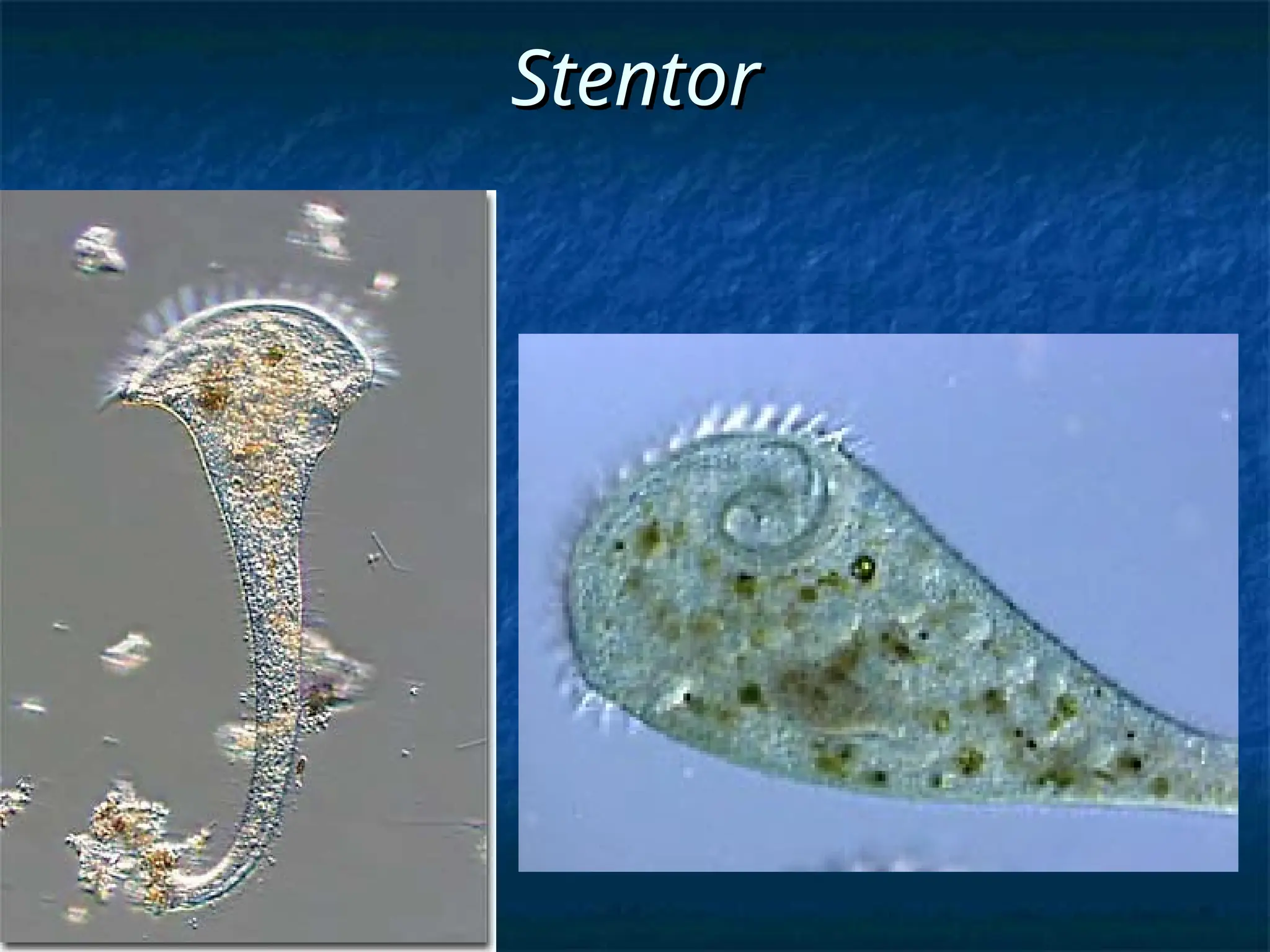 medical Protozoa , human protozoa unicellular parasites.ppt
