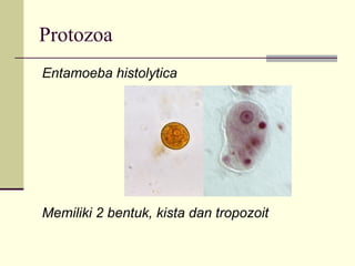 Protozoa adalah ppt berisi tentang protozoa | PPT