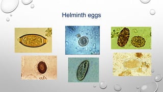 Protozoa and Helminth Parasites ppt by Dr.Prince.C.P | PPTX