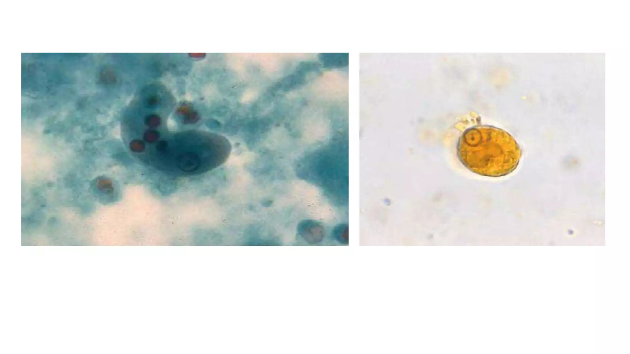 Protozoa and Entamoeba histolytica | PPTX