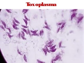 Protozoalogy Slides | PPT