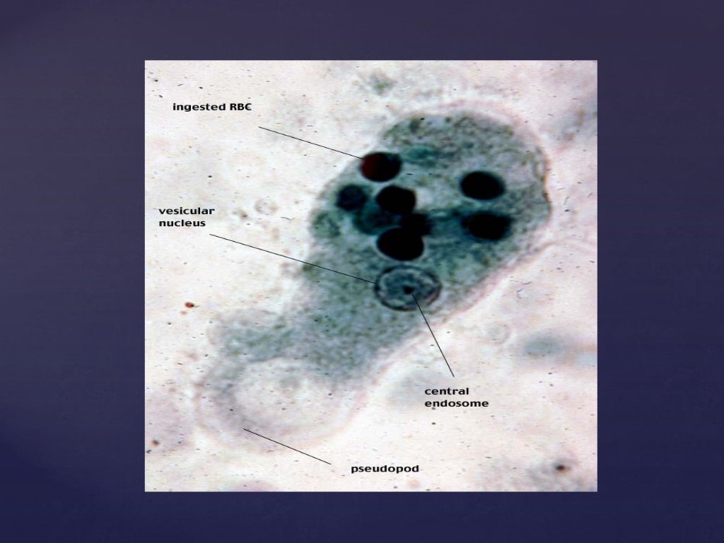 Protozoan Diseases