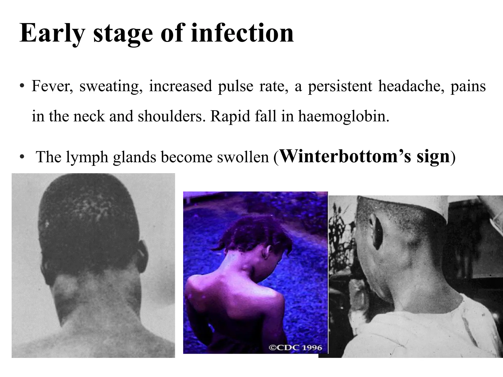 Protozology 2. Flagellates ( Blood, Intestinal, Urogenital) | PPT