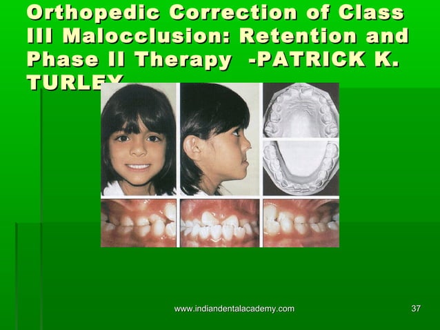 Protraction face mask /certified fixed orthodontic courses by Indian ...