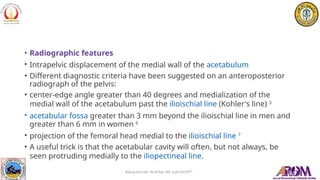 Protrusio Acetabuli -Acetabular protrusion - Otto pelvisi.pptx