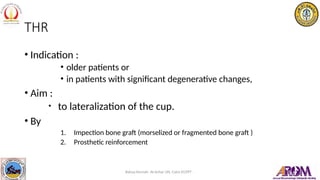 Protrusio Acetabuli -Acetabular protrusion - Otto pelvisi.pptx